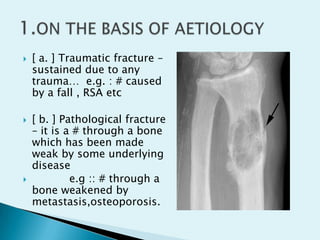Fractures...types and healing of fractures | PPTX