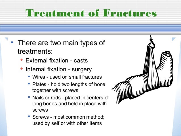 Fractures