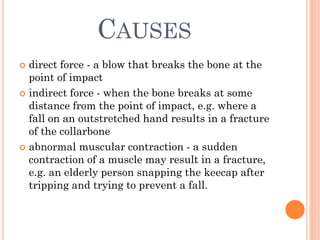 Fractures | PPT