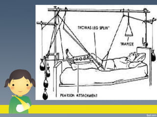 Thomas Splint And Pearson Attachment