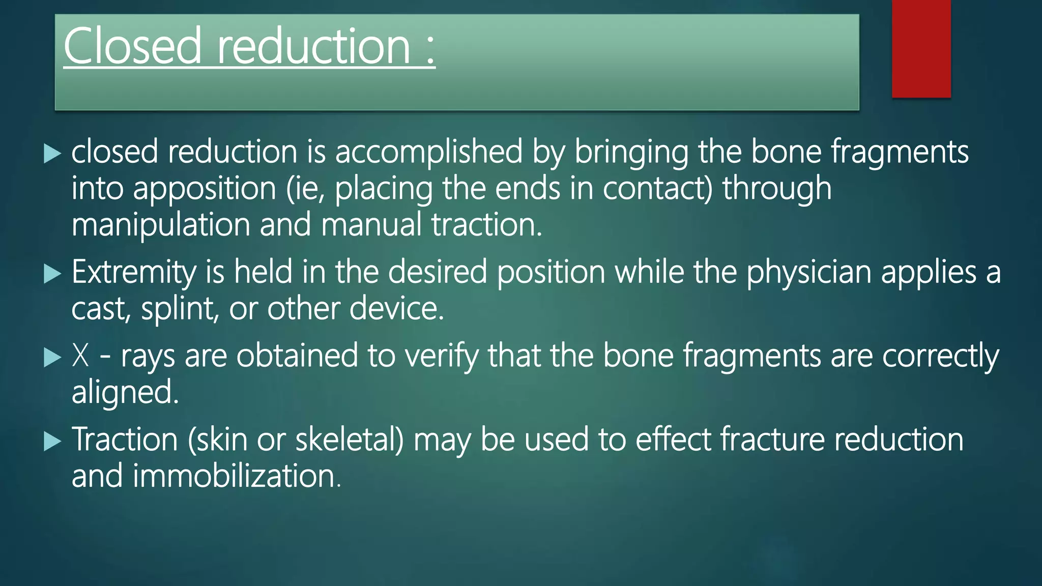 Fractures | PPTX