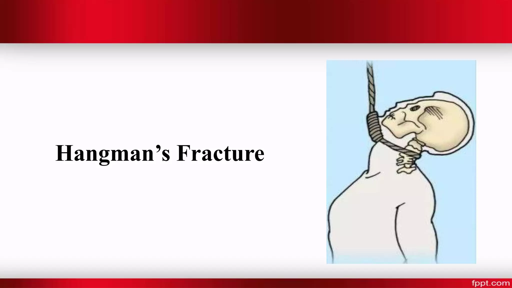 Cervical Fractures(clay shovelers,hangmans,odontoid) | PPTX