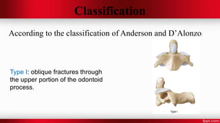 Cervical Fractures(clay shovelers,hangmans,odontoid) | PPTX