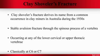Cervical Fractures(clay shovelers,hangmans,odontoid) | PPTX