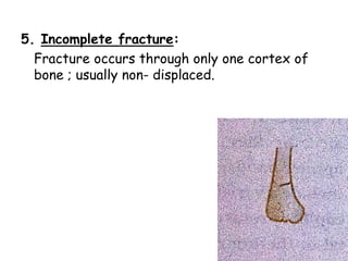 Fractures | PPTX