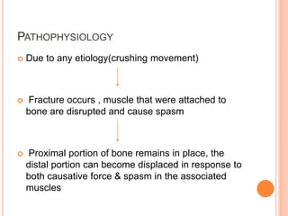 Fractures | PPTX
