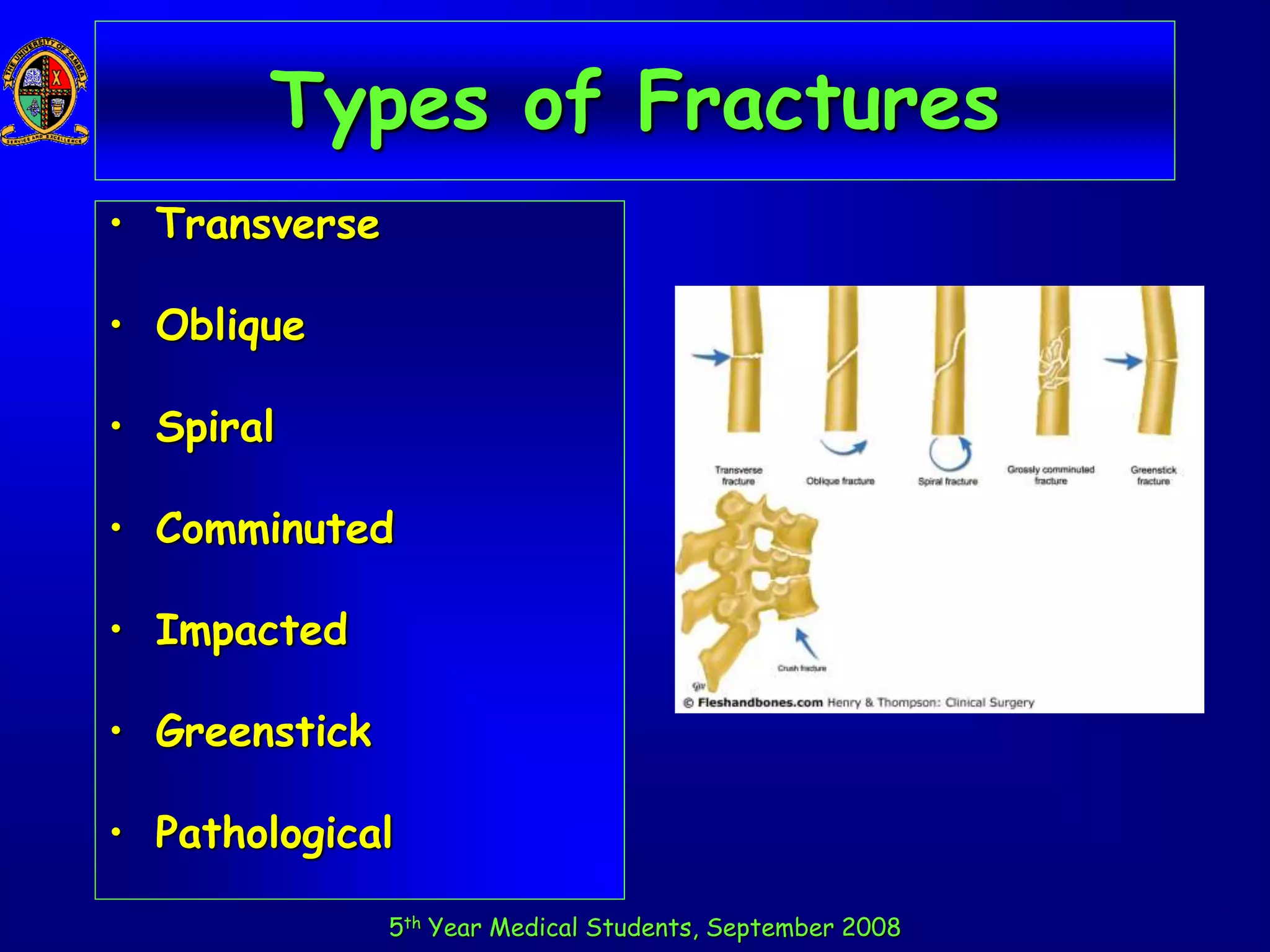 Fractures.ppt