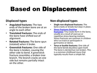 power point presentation fractures note | PPTX