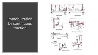 Orthopaedic and surgical conditions - Fractures.pptx