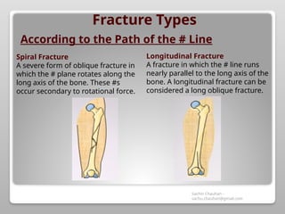 fractures abd classification and management | PPTX