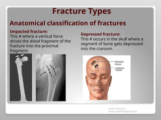 fractures abd classification and management | PPTX