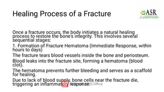 fractures.pdf by kotta pavani bhms 1 st year | PDF