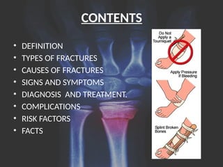 FRACTURES and types of fractures info.pptx