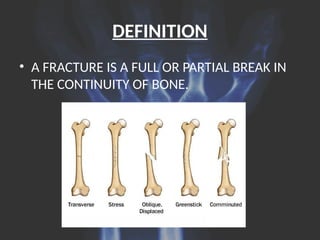 FRACTURES and types of fractures info.pptx