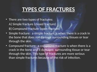 FRACTURES and types of fractures info.pptx