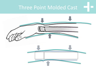 Distal Radius and Wrist Fractures | PPTX