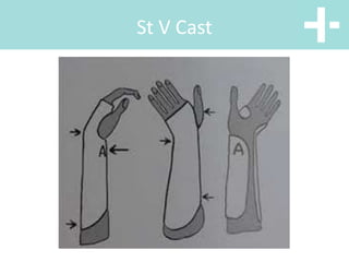 Distal Radius and Wrist Fractures | PPTX