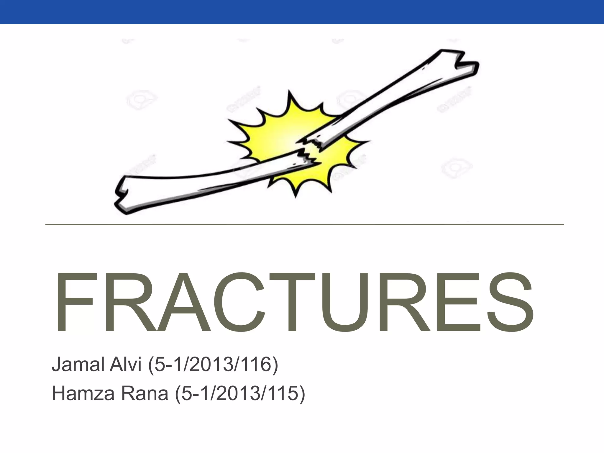 Fractures By Dr Jamal Alvi | PPTX