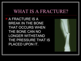 Fractures.ppt by bernita | PPT