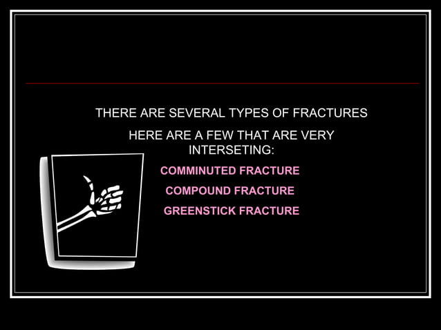 Fractures.ppt by bernita | PPT