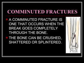 Fractures.ppt by bernita | PPT