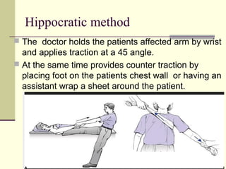 Fractures and Dislocations- Upper-limb | PPT