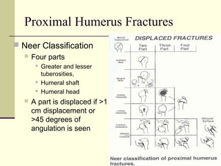 Fractures and Dislocations- Upper-limb | PPT