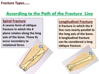 Fractures - general view | PPTX
