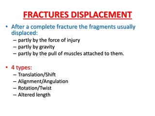 Fractures - general view | PPTX