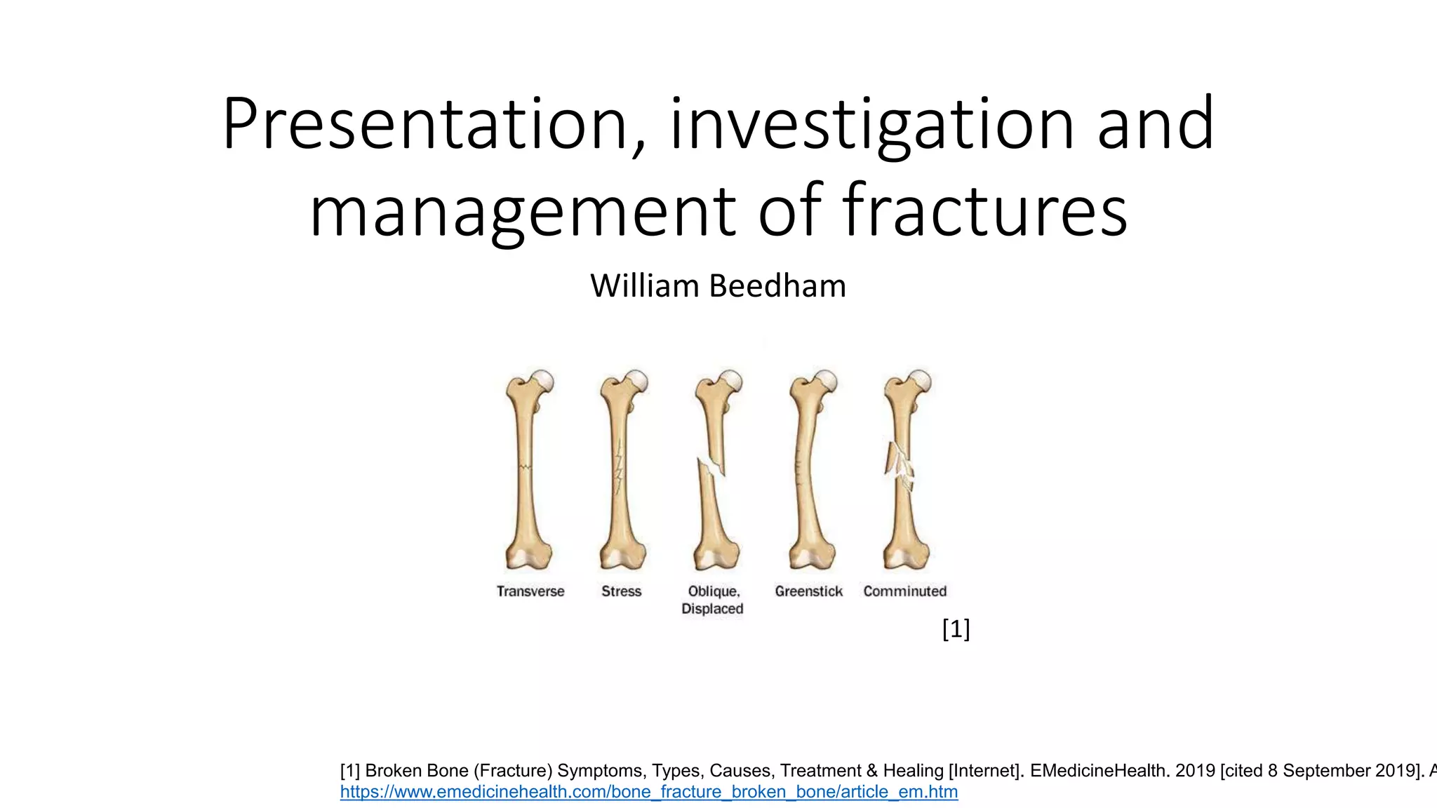 Fractures 4 | PPT