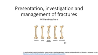 Fractures 4 | PPT