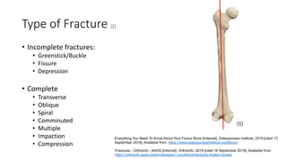 Fractures 4 | PPTX
