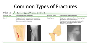 Fractures and Bone healing | PPT