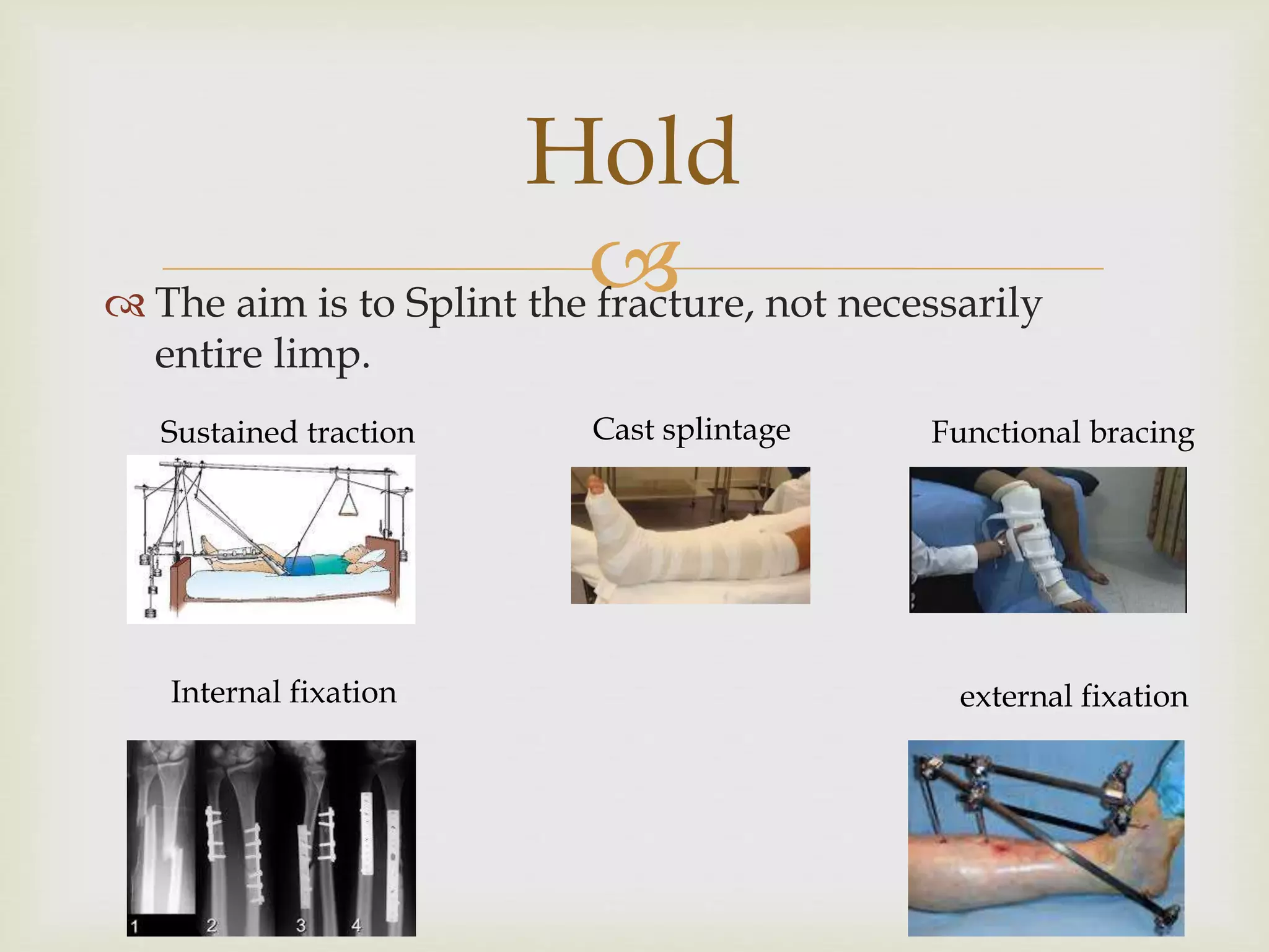 Fractures and dislocations | PPTX