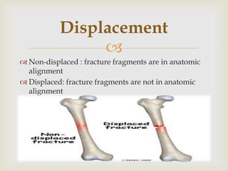 Fractures and dislocations | PPTX