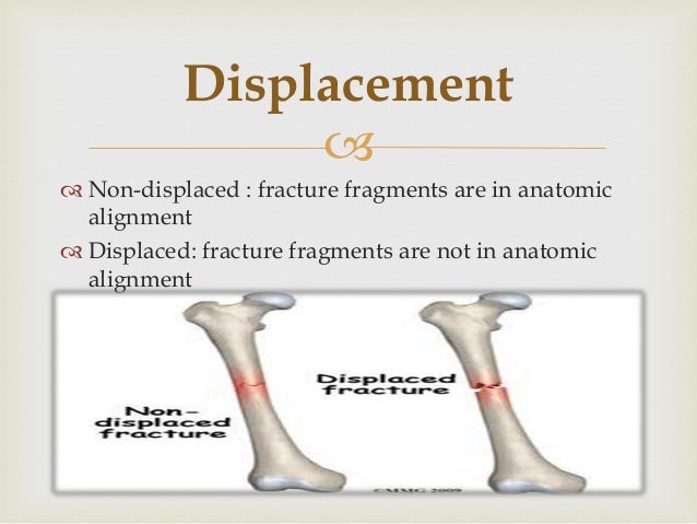 Fractures and dislocations