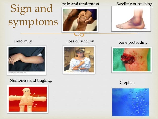 Fractures and dislocations