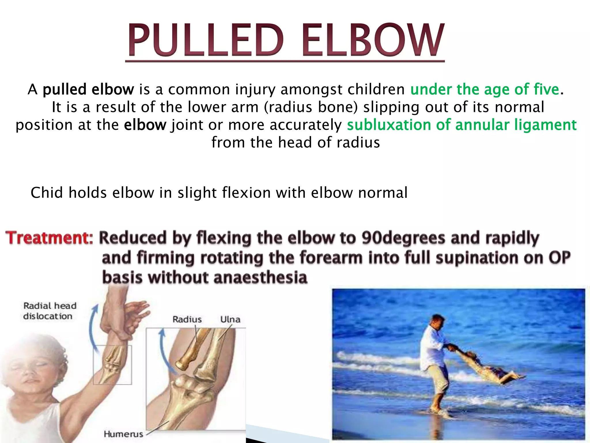 upper limb Fractures and dislocations | PPTX