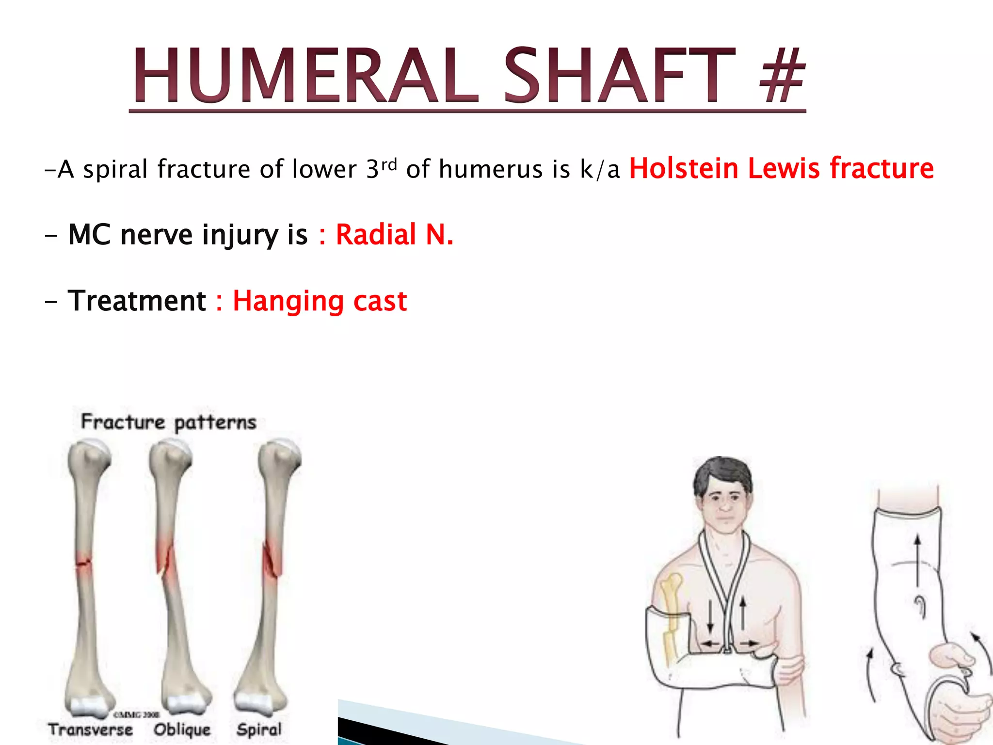 Fractures and dislocations- Upper Limb | PDF