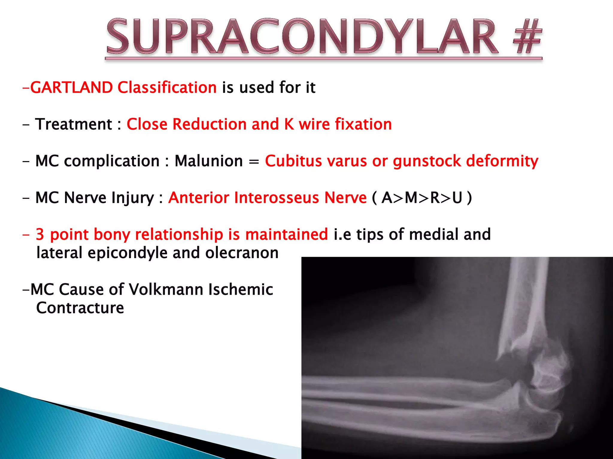 Fractures and dislocations- Upper Limb | PDF