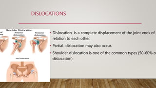Fractures and Dislocations. Of joints pptx | PPTX
