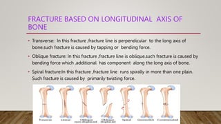 Fractures and Dislocations. Of joints pptx | PPTX