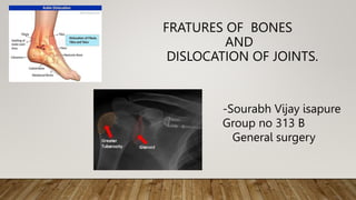 Fractures and Dislocations. Of joints pptx | PPT