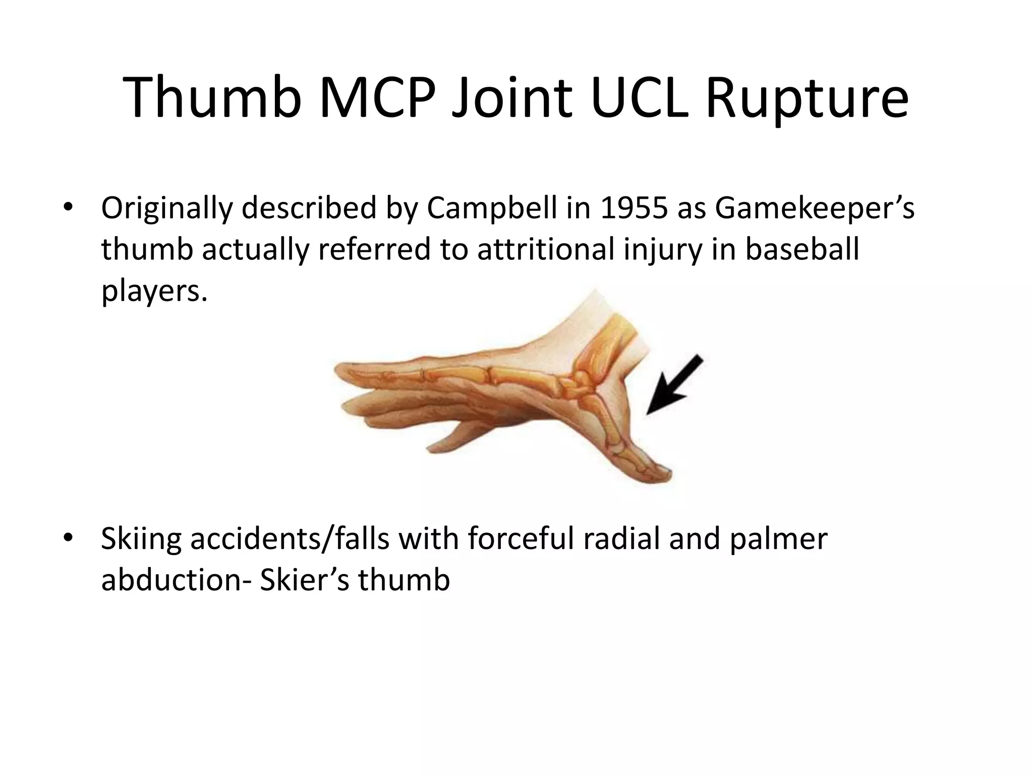 Fractures and dislocations of hand | PPTX