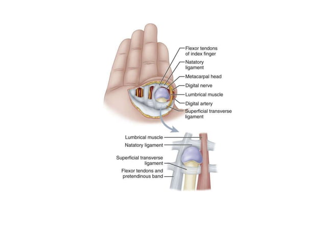 Fractures and dislocations of hand | PPTX | First Aid | Injuries