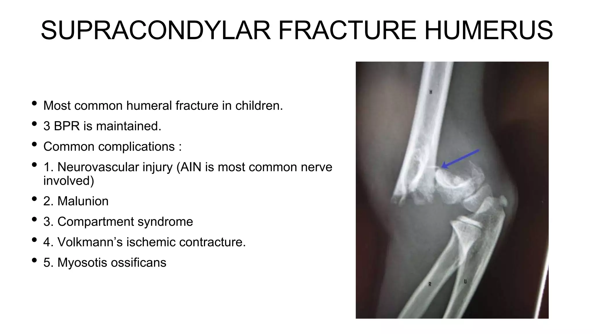 Fractures and dislocation upper limb .pptx