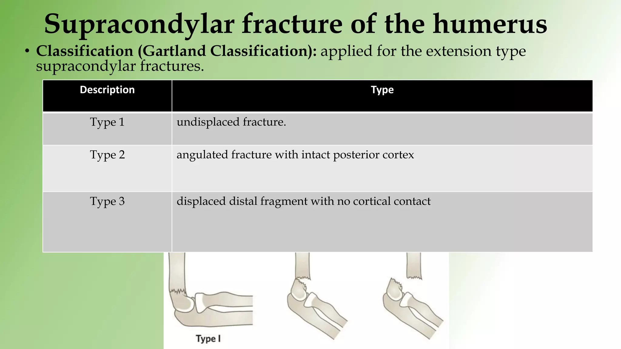fractures around Elbow.pdf