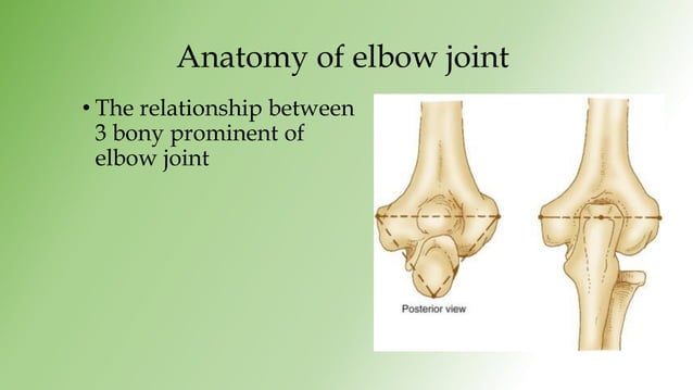 fractures around Elbow.pdf