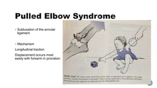 Fractures around elbow joint in children | PPTX