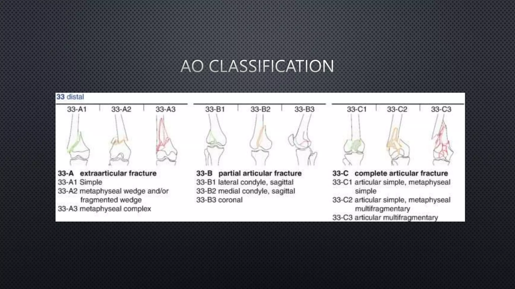 fractures around knee.pptx
